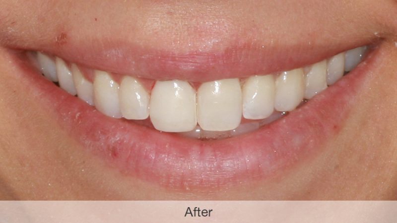 Restorative Dentist - Hampstead
