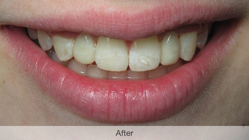 Implant Dentist - Hampstead