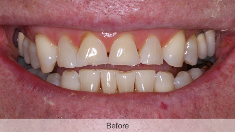 Seniour Care Dentist - Hampstead