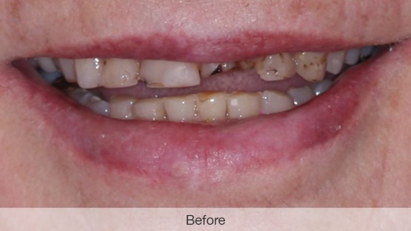 Restorative Dentist - Hampstead