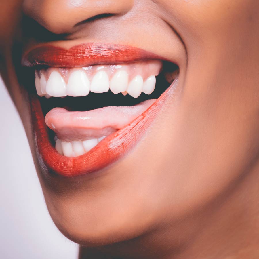 Dentures - Hampstead